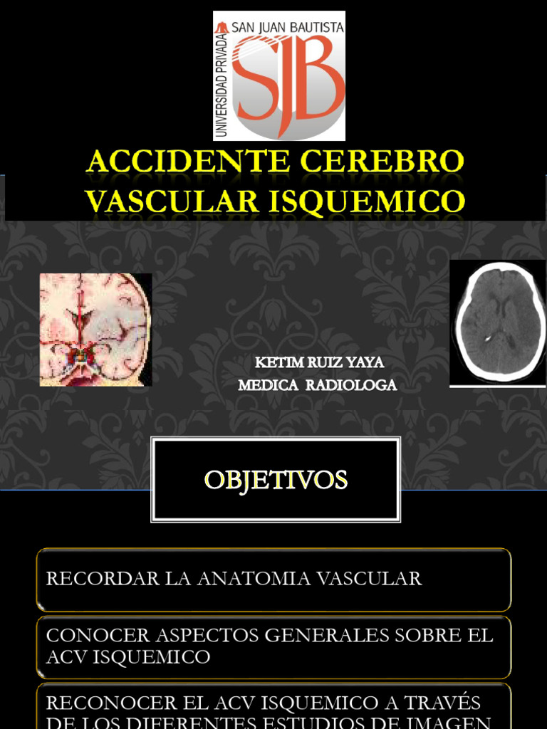 Diagnóstico y Manejo del ACV Isquémico | PDF | Isquemia | Carrera