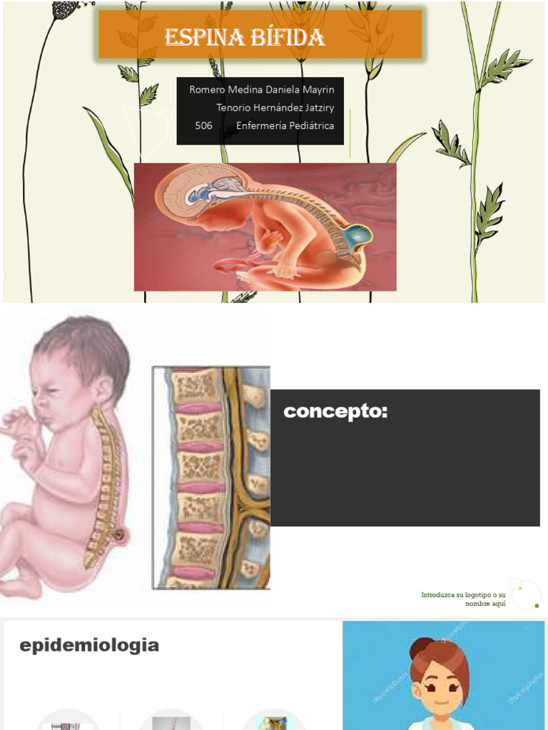 Espina Bífida-Pediatria | PDF | Especialidades Medicas | Sistema nervioso