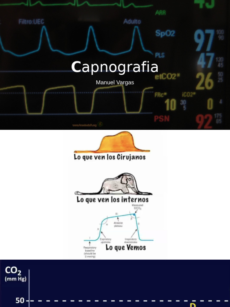 Capnografia | PDF