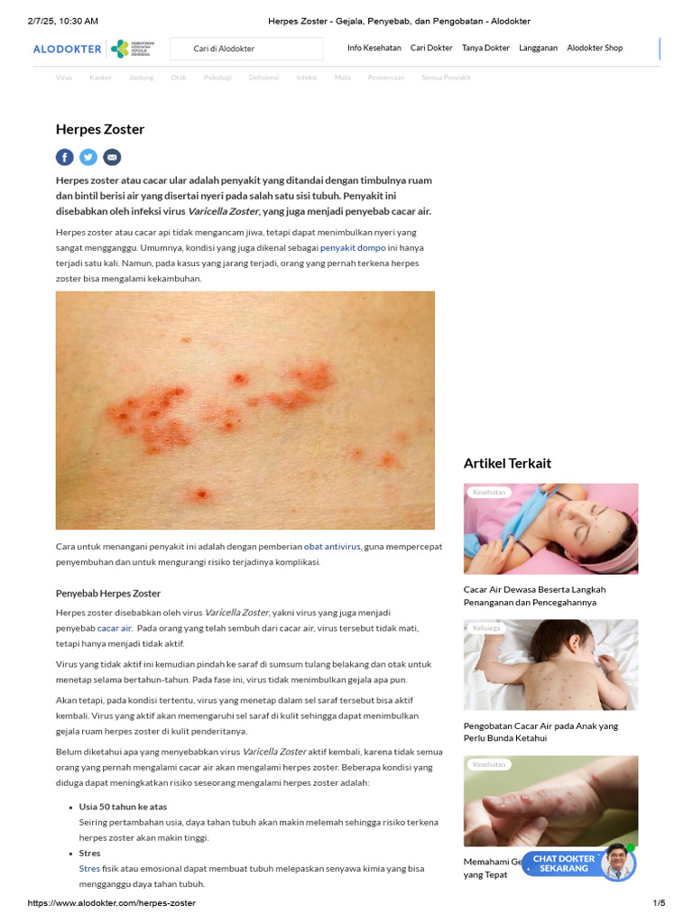 Herpes Zoster - Gejala, Penyebab, Dan Pengobatan - Alodokter | PDF