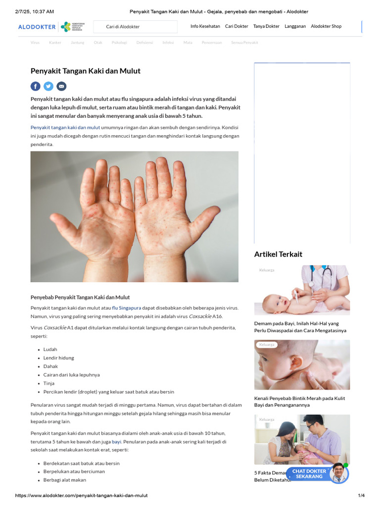 Penyakit Tangan Kaki dan Mulut - Gejala, penyebab dan mengobati - Alodokter | PDF