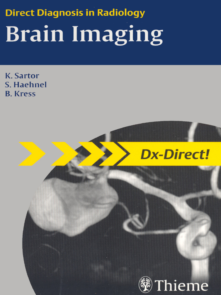 Brain Imaging | PDF | Human Diseases And Disorders | Neurological Disorders