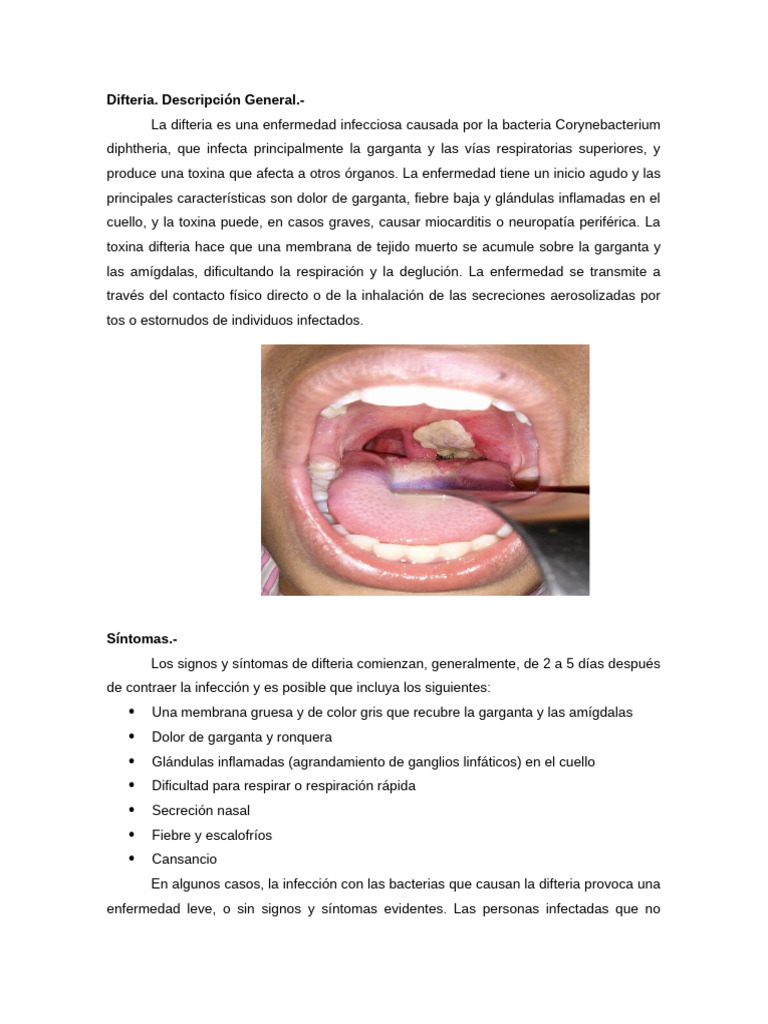 Difteria: Síntomas, Causas y Prevención | PDF | Pediatría | Medicina ...