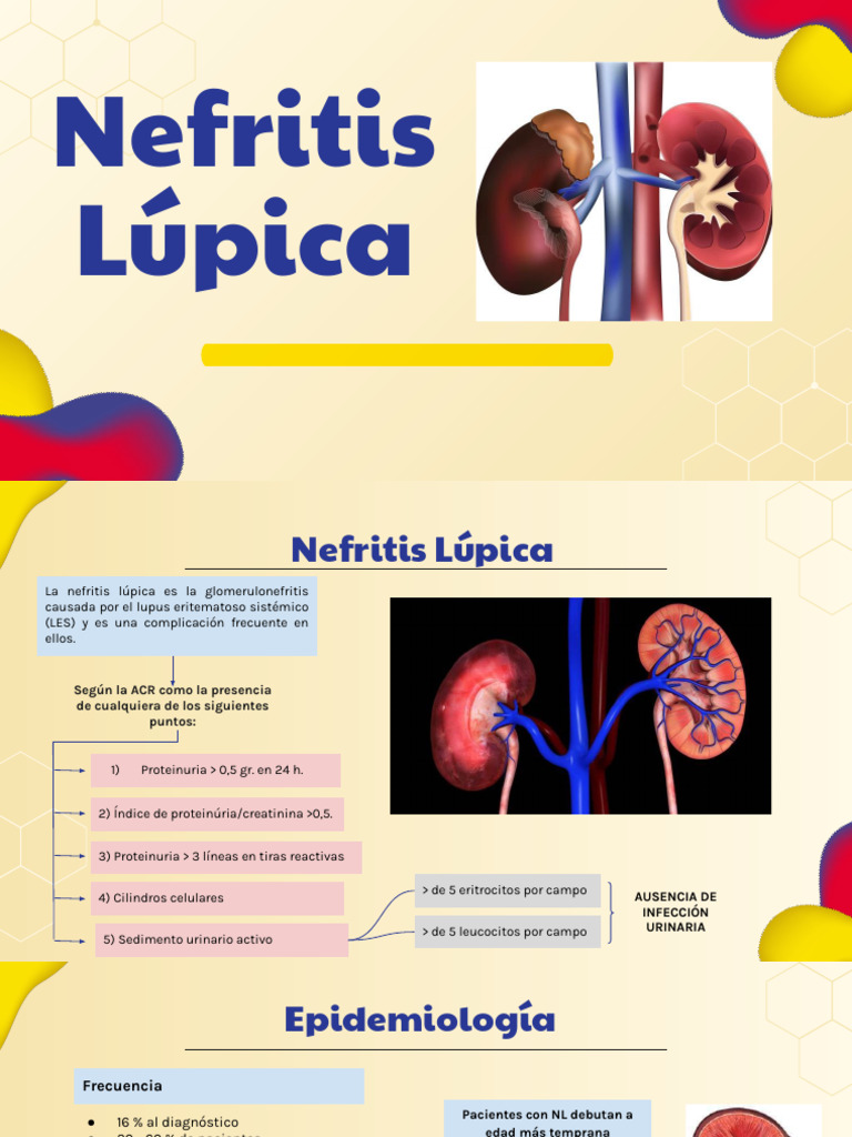 Nefritis Lúpica - S. Metabólico y Enfermedad Renal | PDF | Angiotensina ...