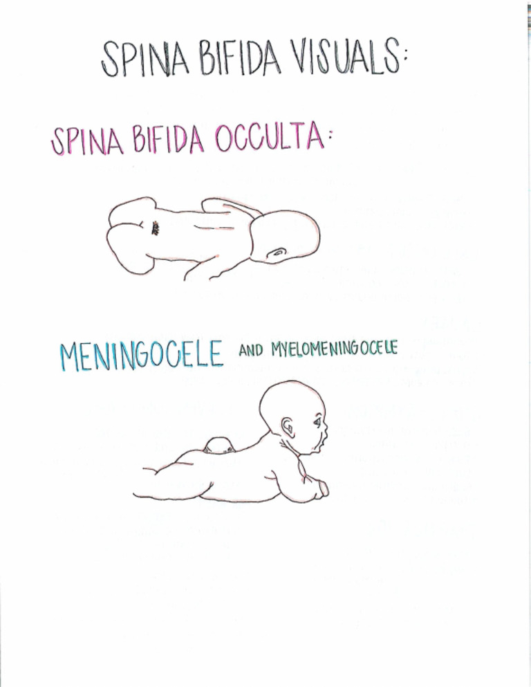spinal bifida visual | PDF