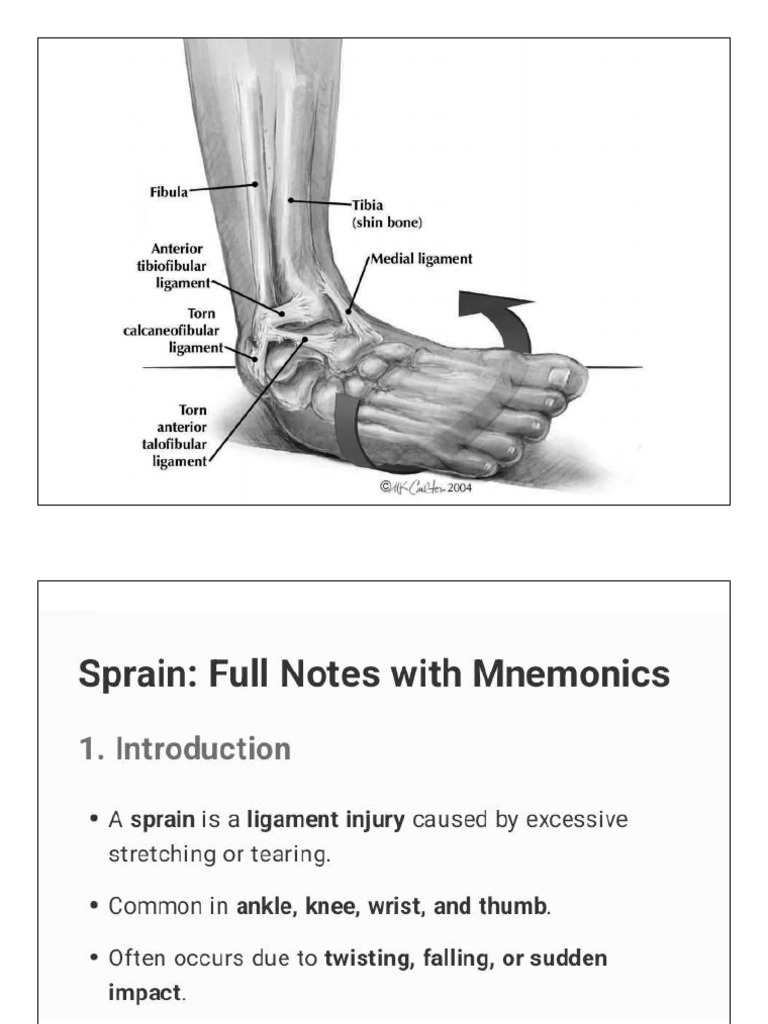 Sprain Full Notes | PDF