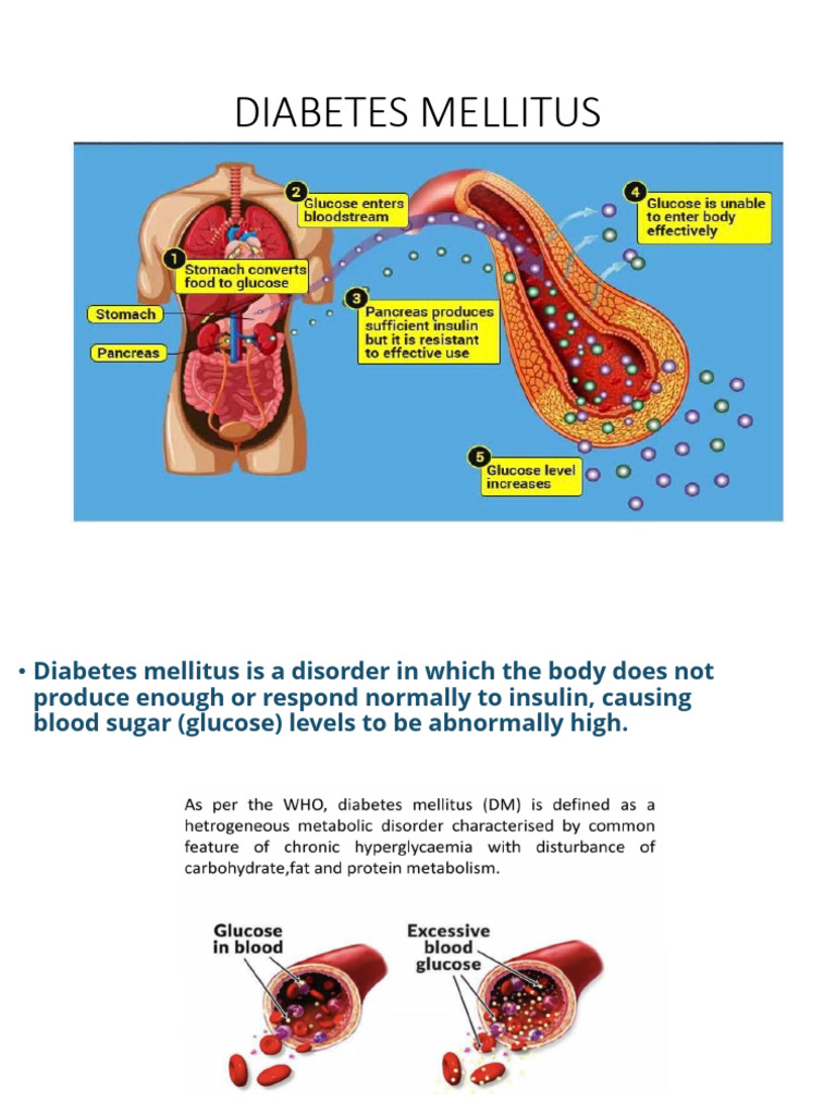 Understanding Diabetes Mellitus Types | PDF | Diabetes | Pancreas