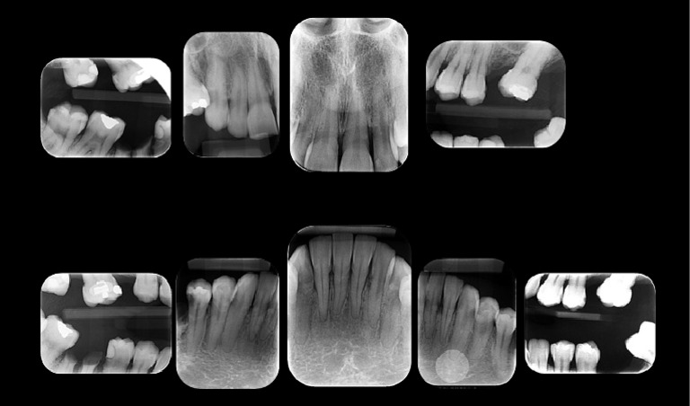 Radiografias | PDF