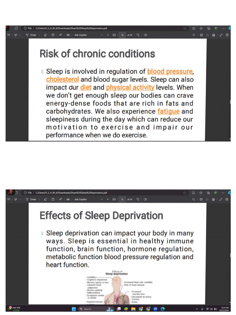 Sleep Deprivation | PDF