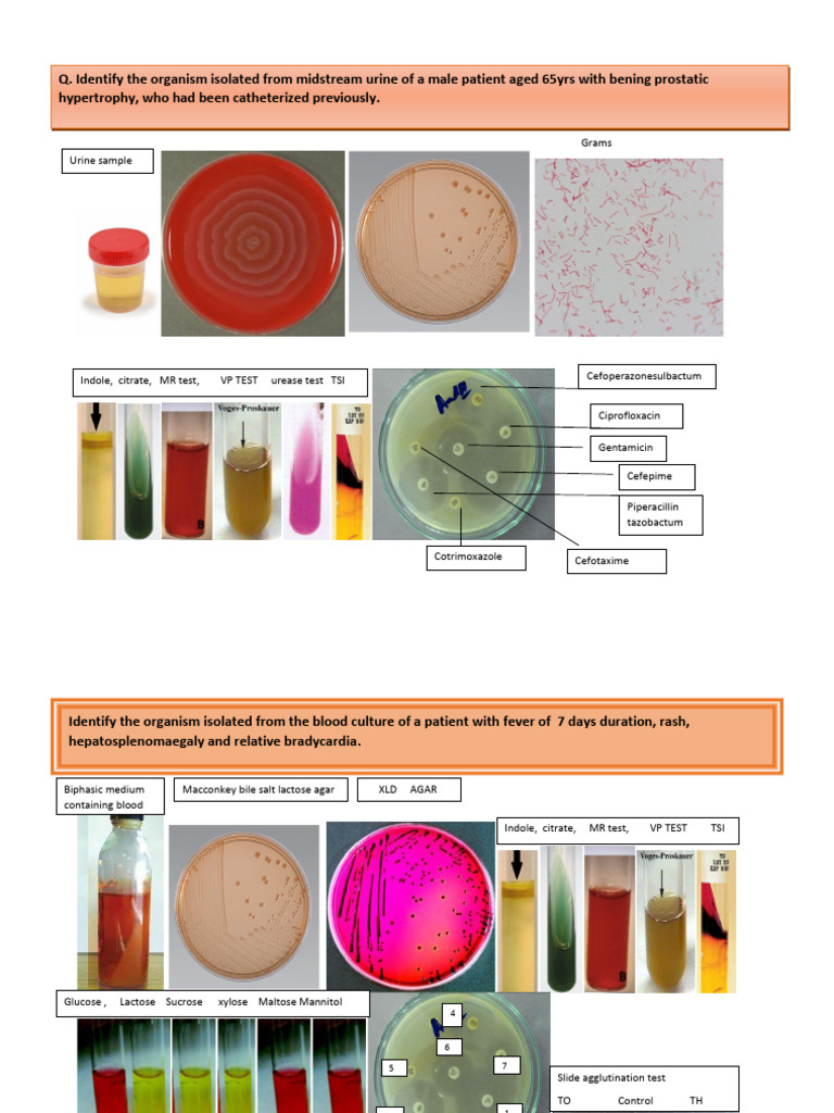Microbial Identification in Clinical Samples | PDF | Microbiology ...