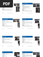 Ball Catcher's View X-Ray Technique | PDF