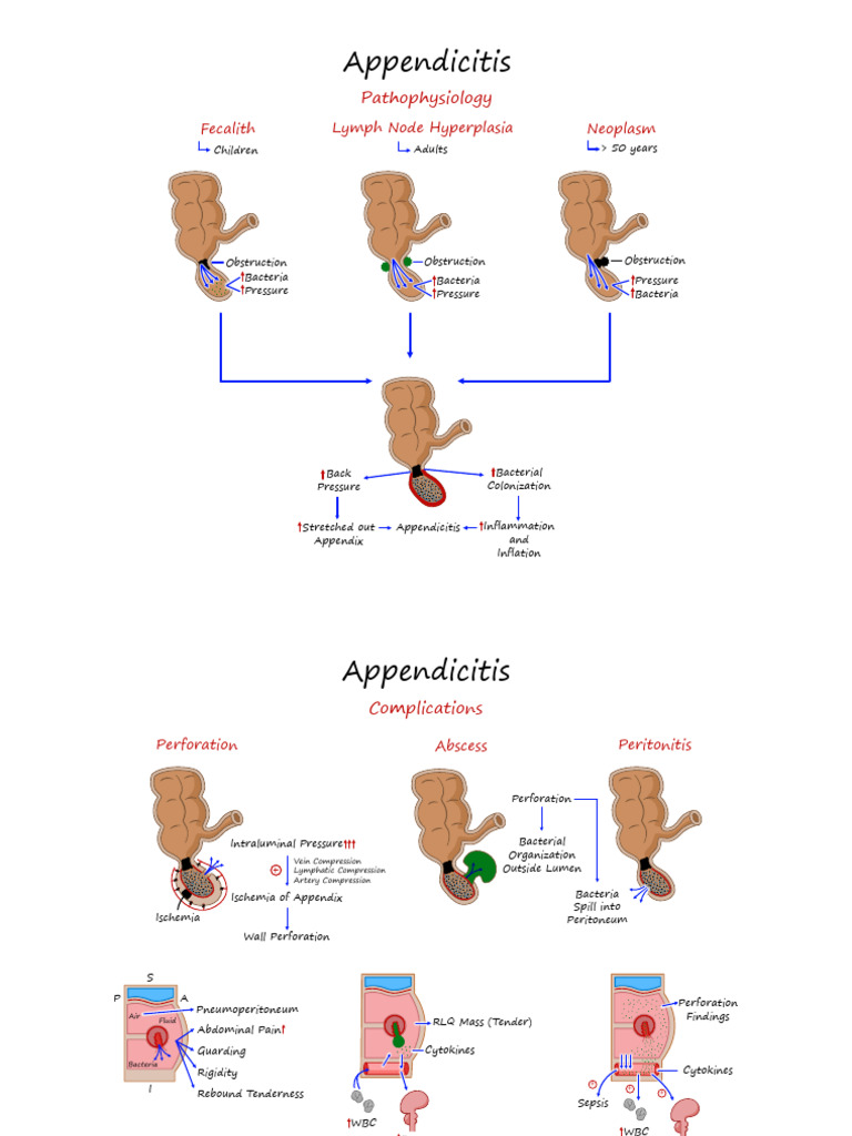 16 - Appendicitis (Illustrations Key) | PDF | Diseases And Disorders | Medical Specialties