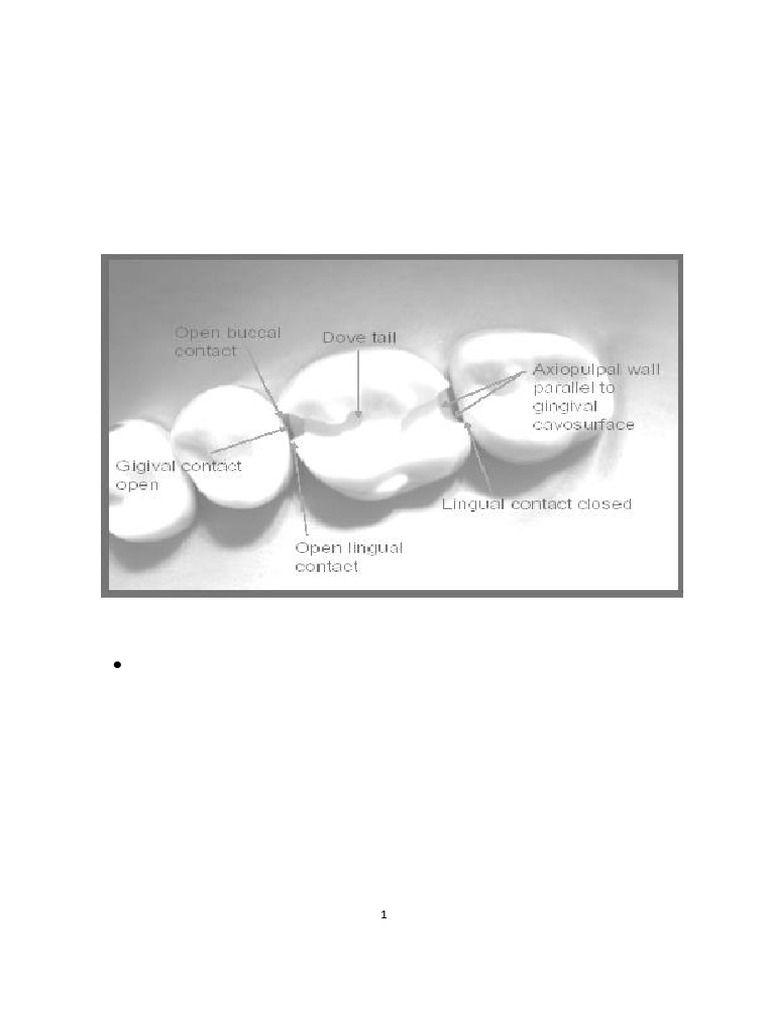 Class II Amalgam Restoration Guide | PDF | Dental Anatomy | Tooth