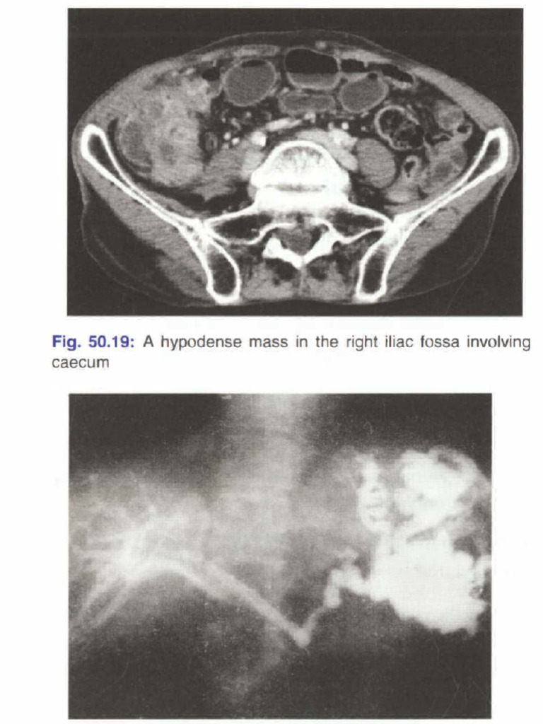 Xray Surgery | PDF | Abdomen | Medical Specialties