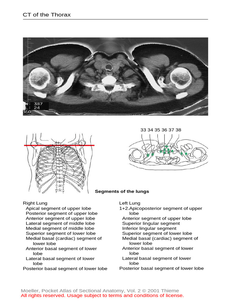 Thoracic CT Anatomy and Lung Segments | PDF | Abdomen | Thorax