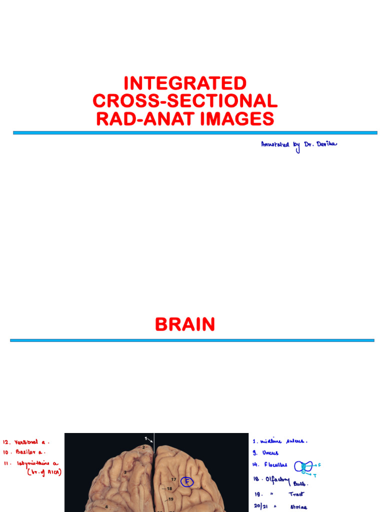 CROSS-SECTIONAL RAD-ANAT Annotated by DR - Devika | PDF | Aorta ...