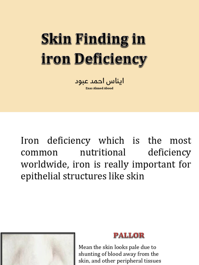 Skin Disorders of Iron Deficient - 20250118 - 202007 - 0000 | PDF