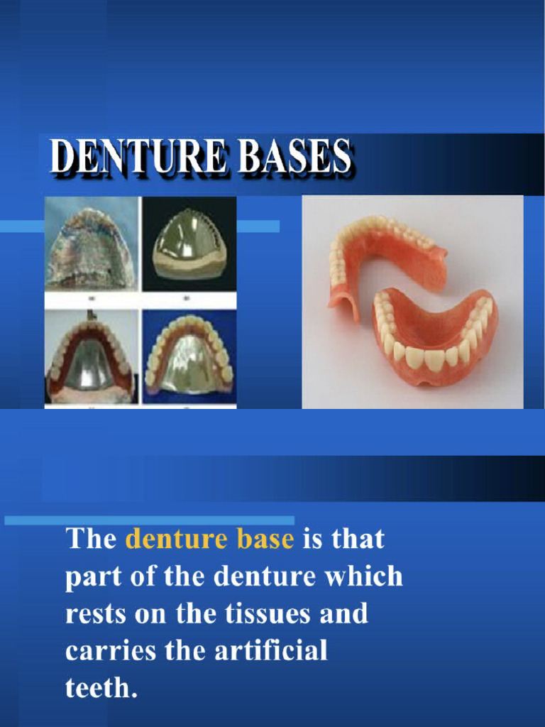 Acrylic Denture Base | PDF
