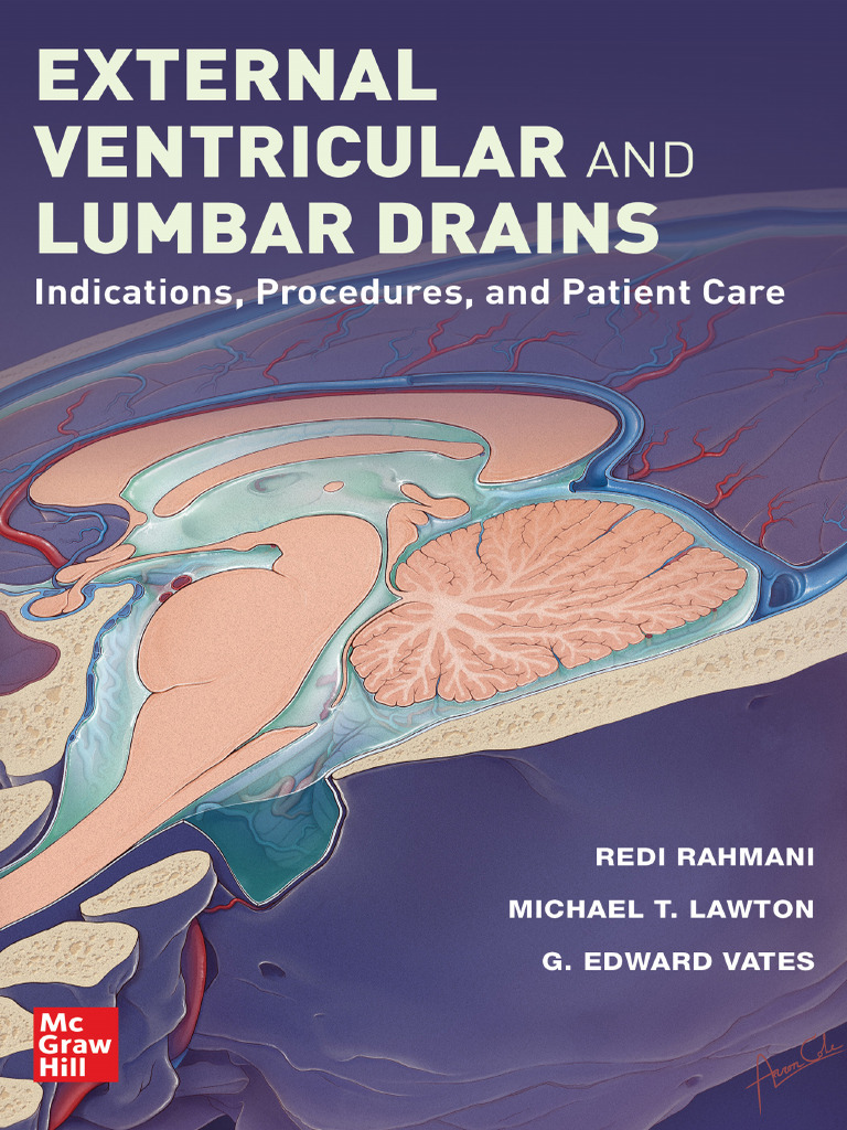 External Ventricular and Lumbar Drains Indications, Procedures | PDF | Cerebrospinal Fluid ...