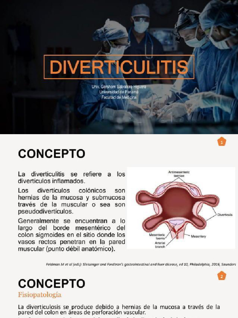 Diverticulitis | PDF