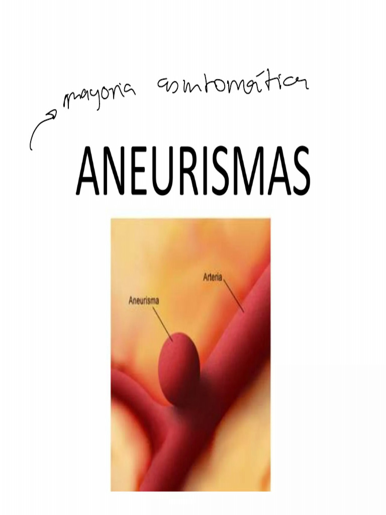Aneurismas PDF | PDF