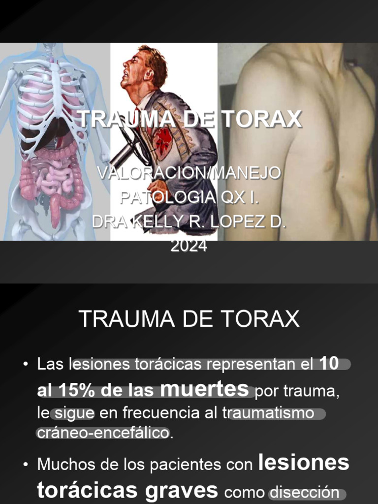 TRAUMA DE TORAX , | PDF | Tórax | Especialidades Medicas