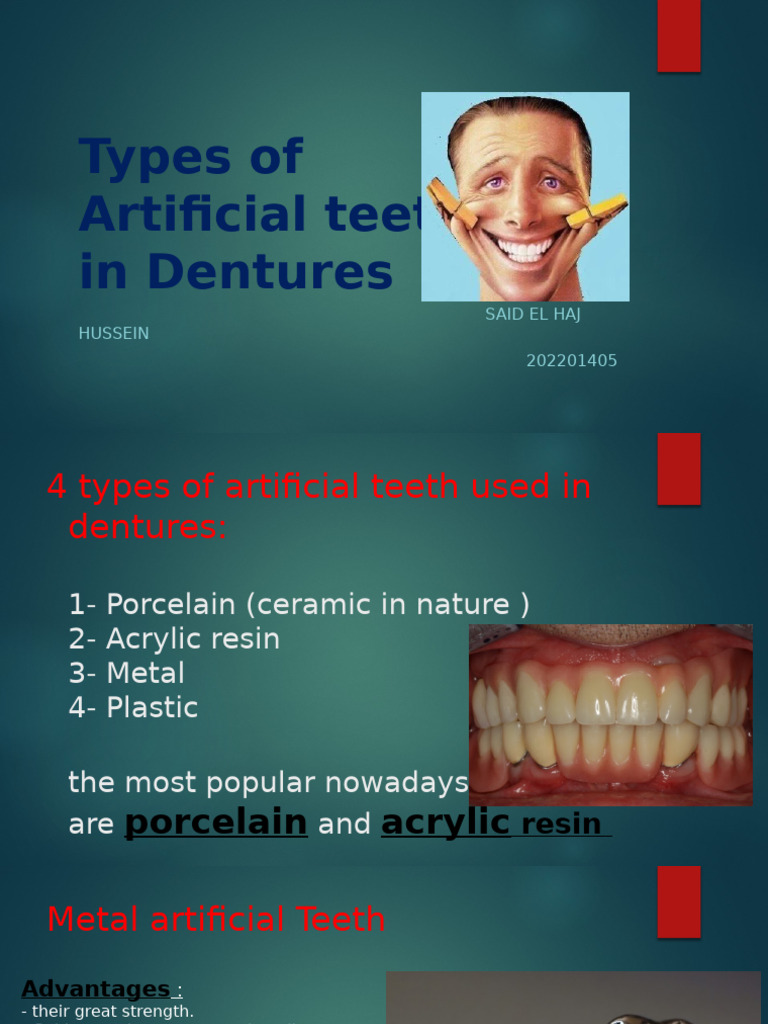 Types of Artificial Teeth in Dentures | PDF | Dentures | Poly(Methyl ...