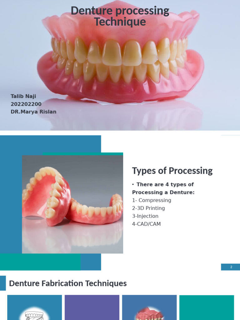 Taleb Denture Processing Removable Assignment | PDF | Dentures | 3 D Printing
