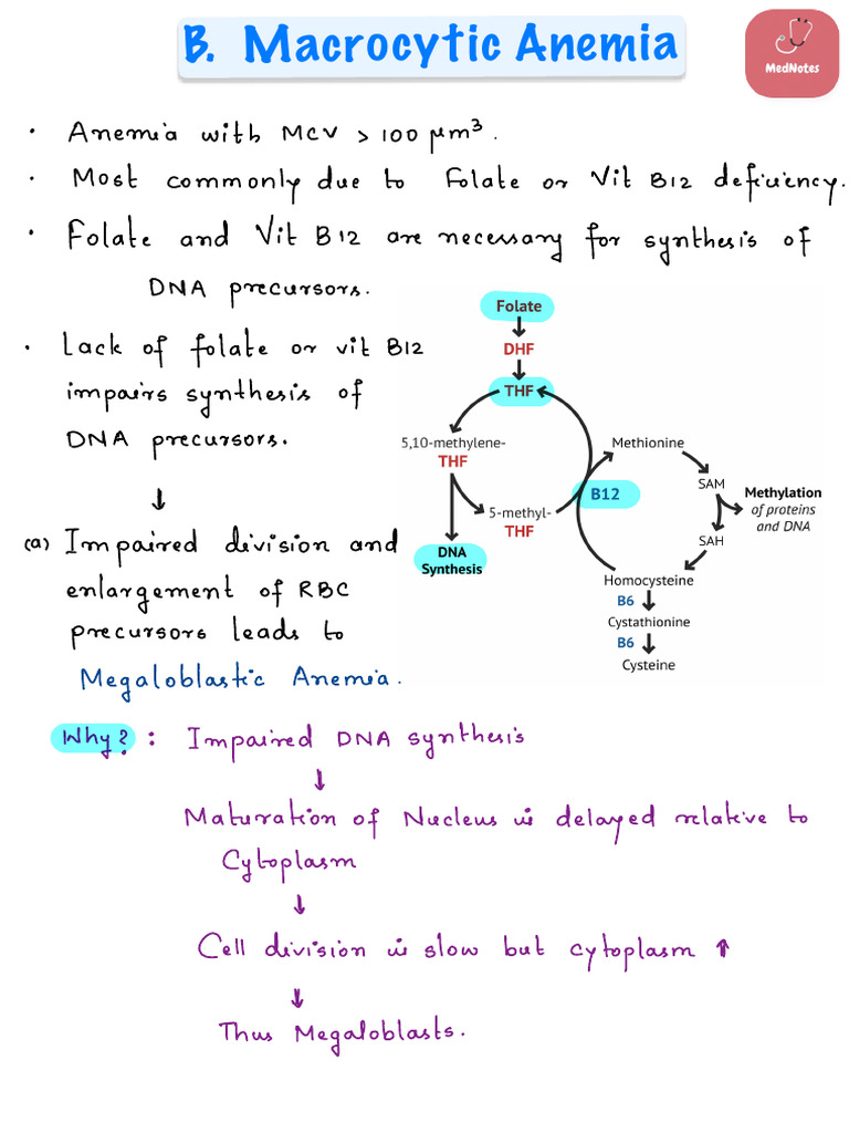 Anemia - 4 (Macrocytic Anemia) | PDF