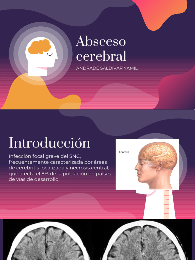 Absceso cerebral: diagnóstico y tratamiento | PDF | Meningitis ...