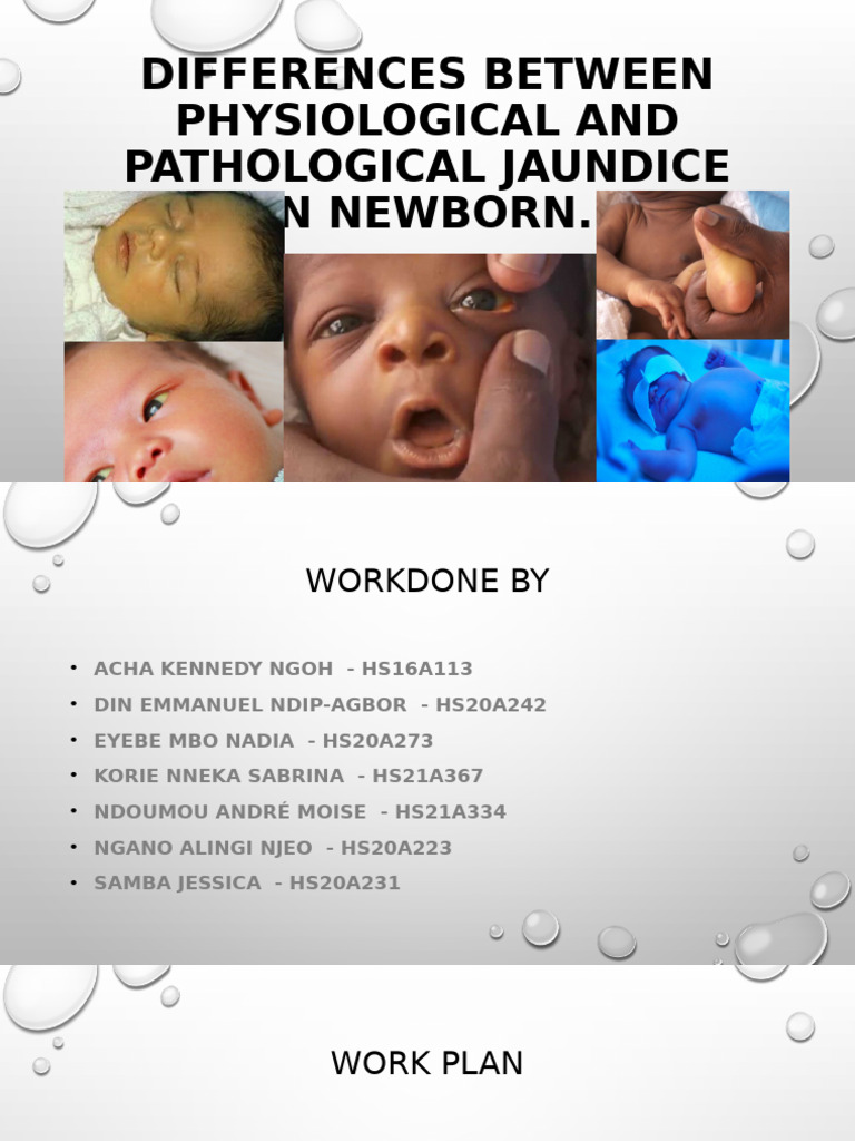 Jaundice in Newborns: Physiological vs Pathological | PDF | Medical ...
