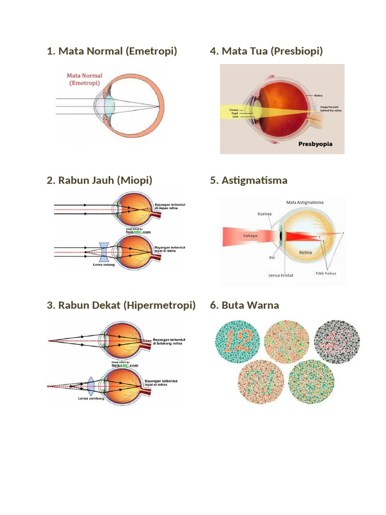 6 Jenis Mata | PDF
