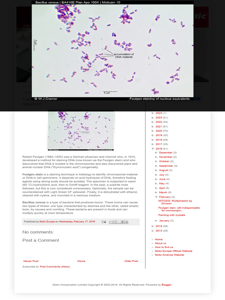 Motic Europe Blog Feulgen Stain, Still Indispensable For Microscopic ...