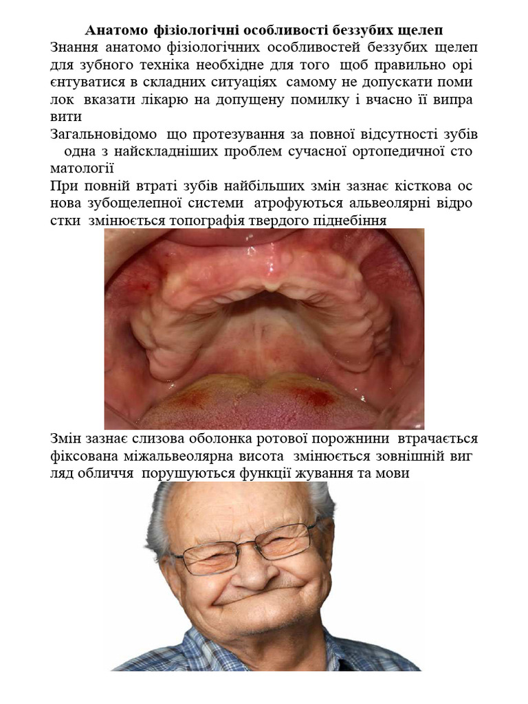 Osoblyvosti Bezzubyh Shelep | PDF