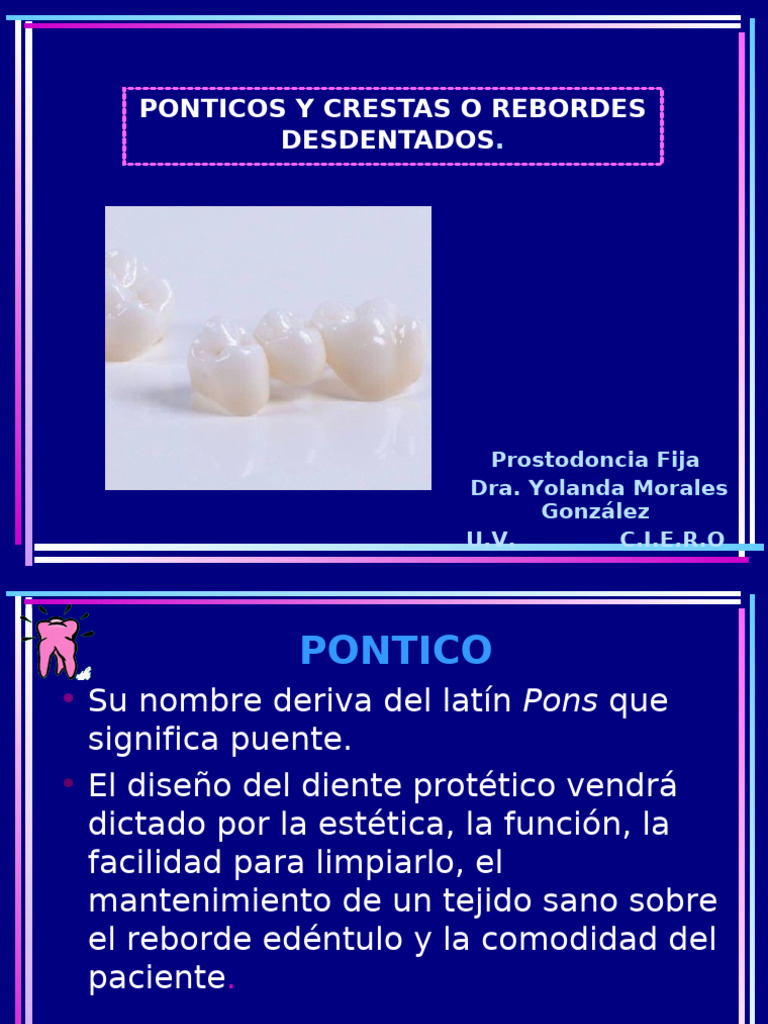 TiPos D Ponticos | PDF | Diente