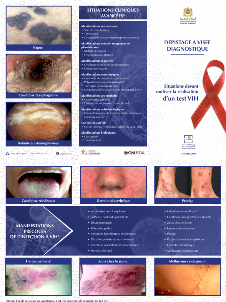 Tests VIH : Signes et Manifestations Cliniques | PDF | SIDA | Candidose