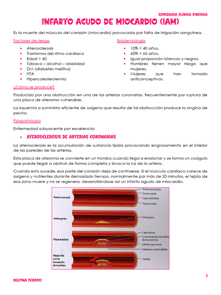 INFARTO AGUDO DE MIOCARDIO | PDF | Infarto de miocardio | Aterosclerosis