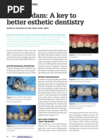 Dental Rubber Dam Tools Guide | PDF