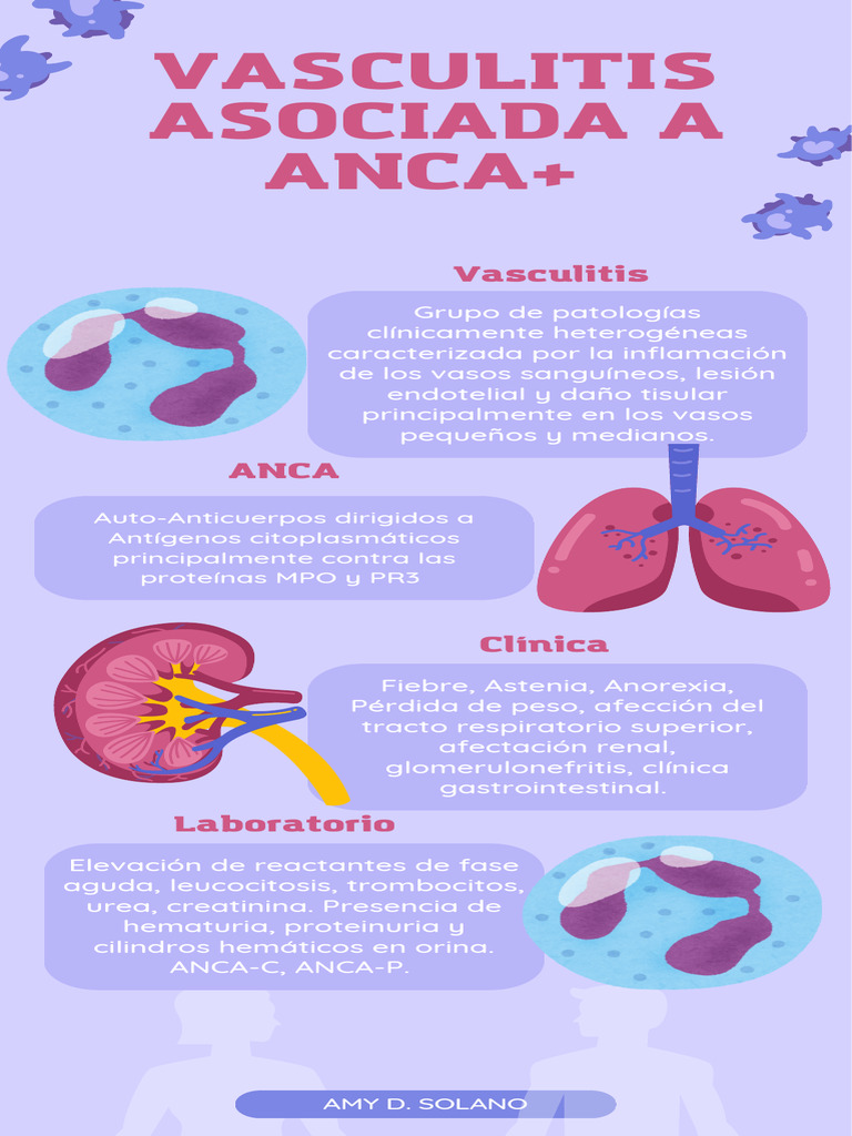 Síntomas de Vasculitis ANCA+ | PDF