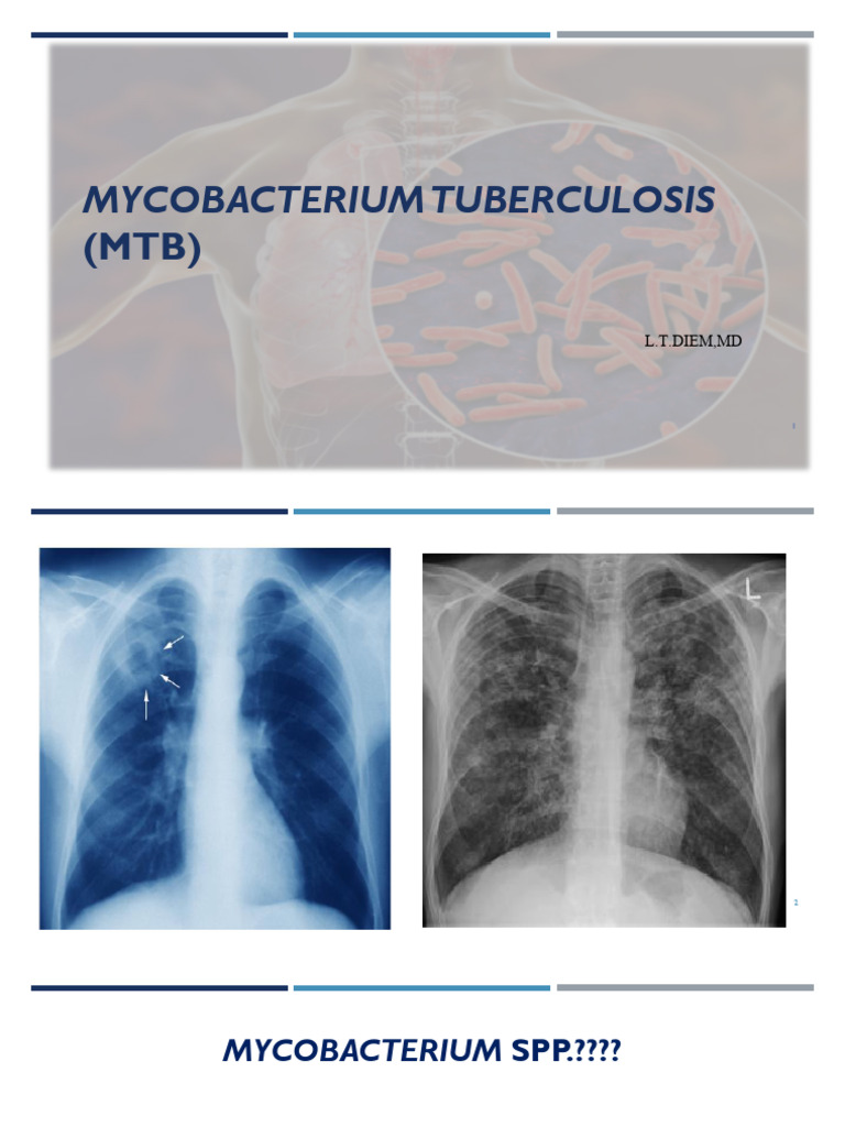 Lý Thuyết - Tuberculosis - Diễm | PDF | Mycobacterium | Tuberculosis