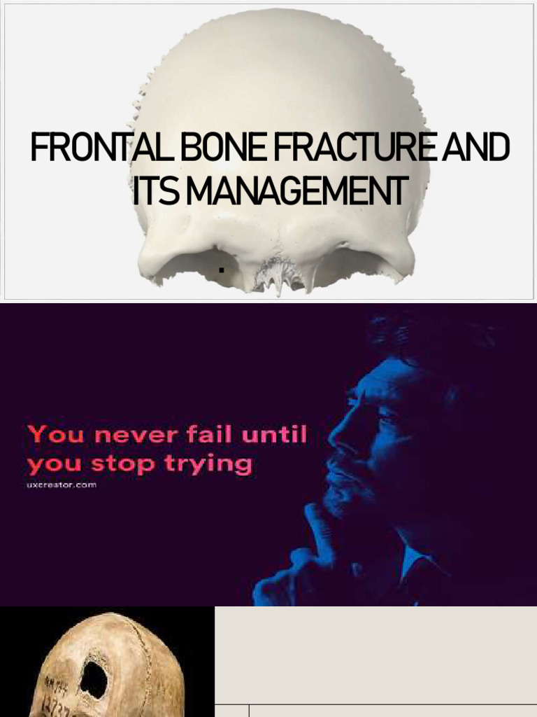 Frontal Bone Fracture Management Guide | PDF | Skeletal System | Human ...