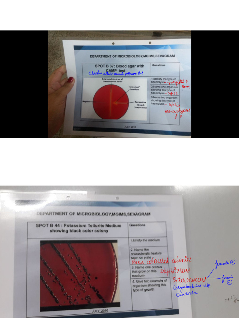 Micro Spots | PDF | Immunology | Microbiology