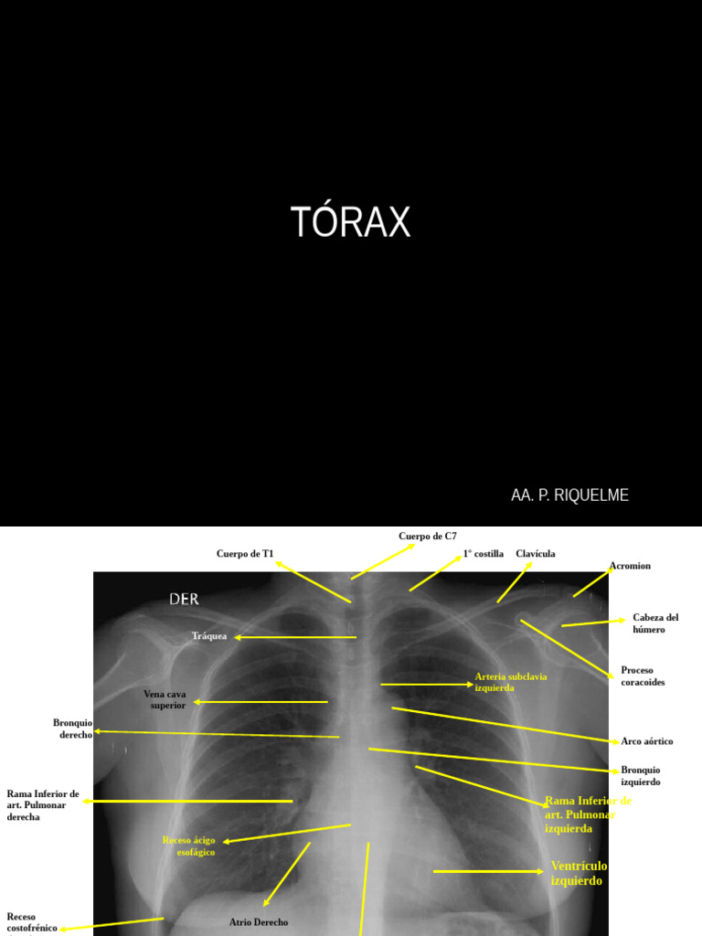 EXAMEN ANATO (1) | PDF | Aorta | Abdomen
