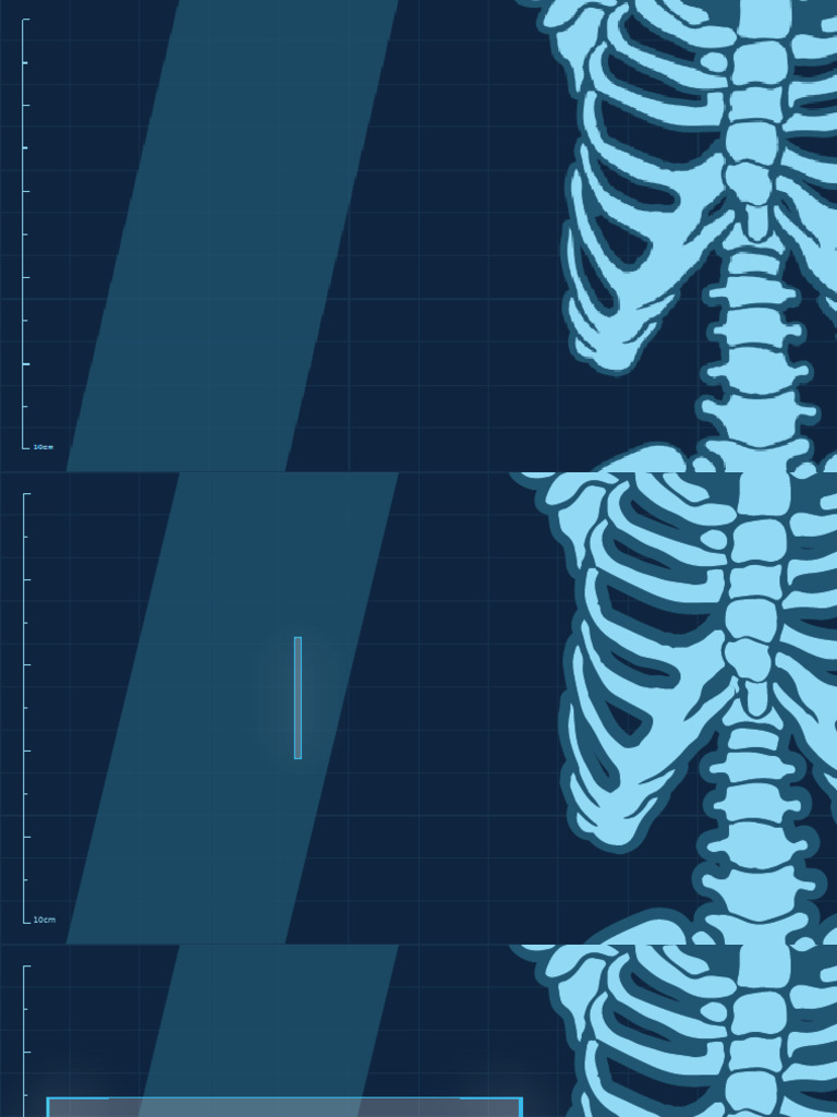 Juanillo PPT Cute Xray | PDF | X Ray | Radiation