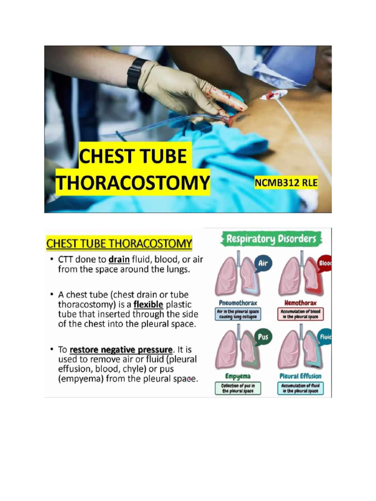 312 Chest Tube Thoracostomy | PDF