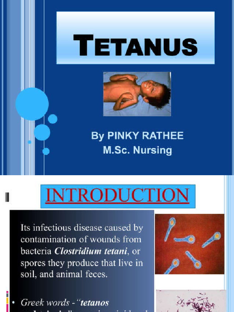 Tetanus | PDF