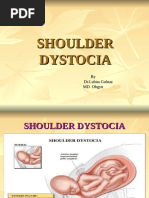 Zavanelli Procedure | PDF | Childbirth | Caesarean Section