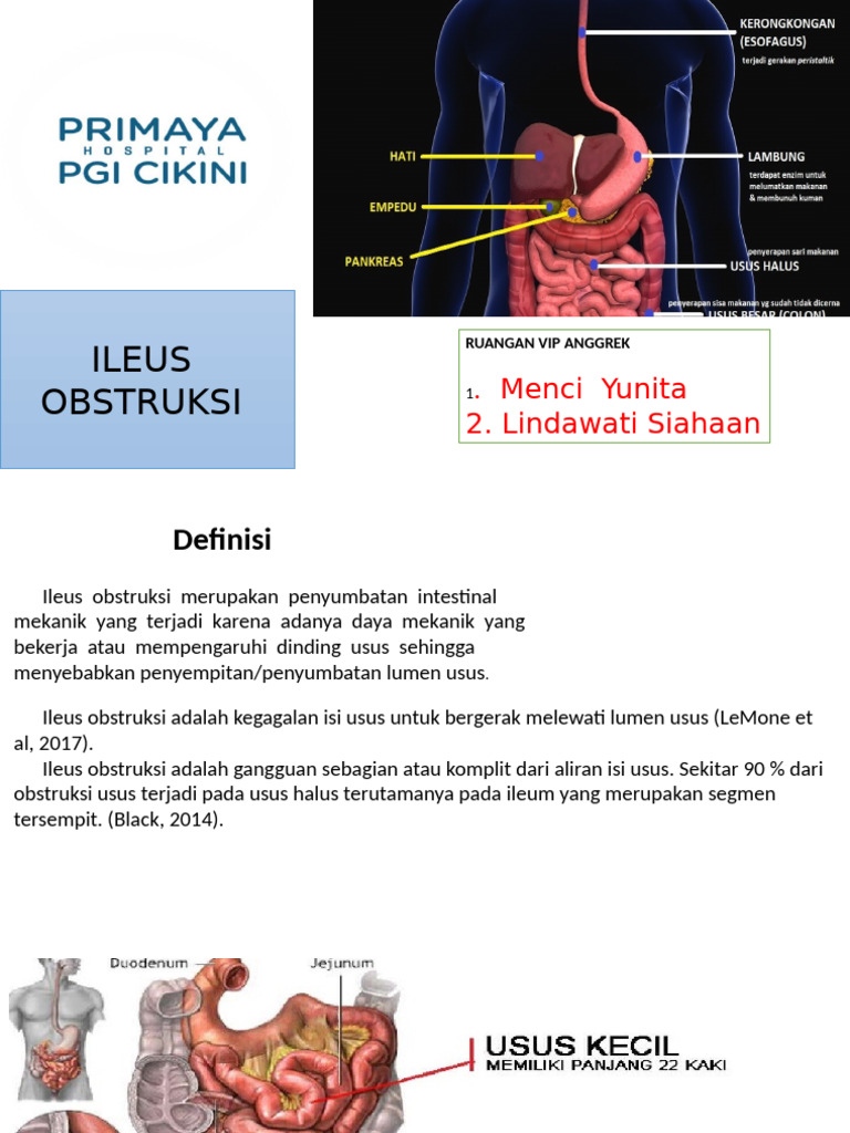 Ileus | PDF