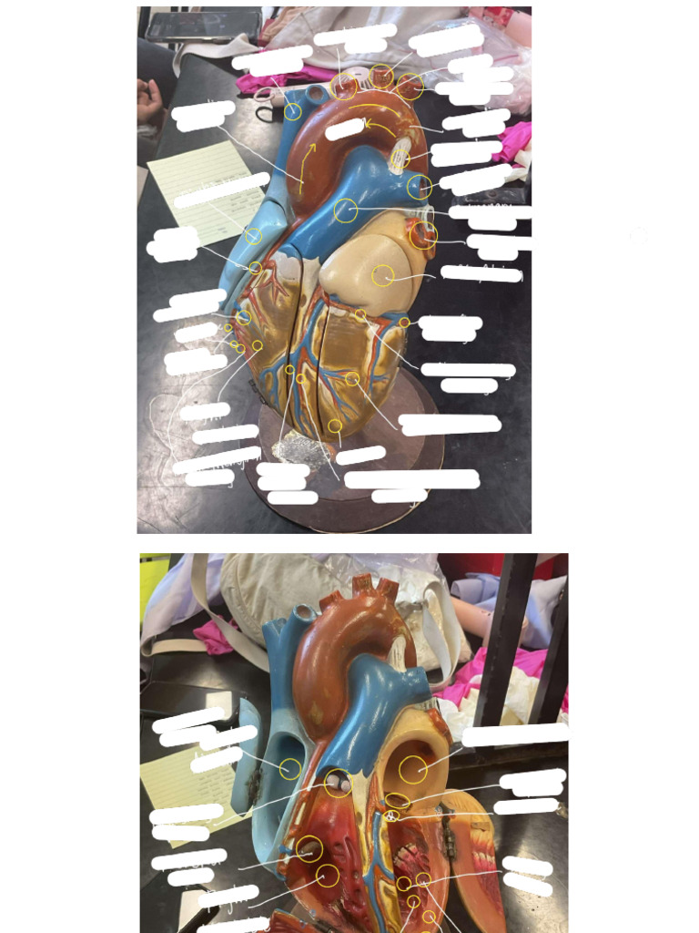 Heart Moving Exam | PDF
