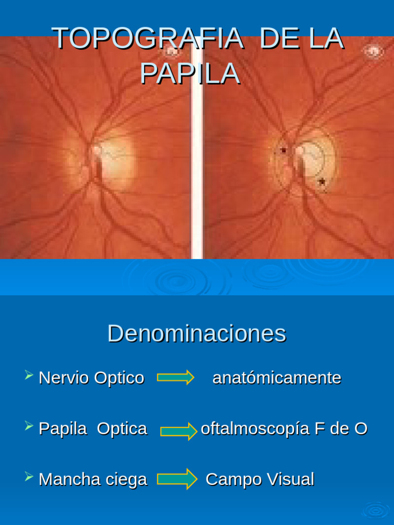 Topografía y Morfología de la Papila Óptica | PDF | Óptica ...